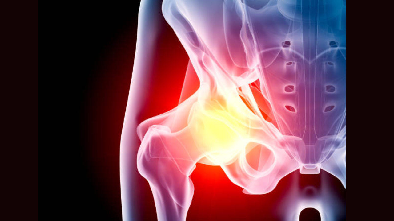 Understanding different types of hip arthritis