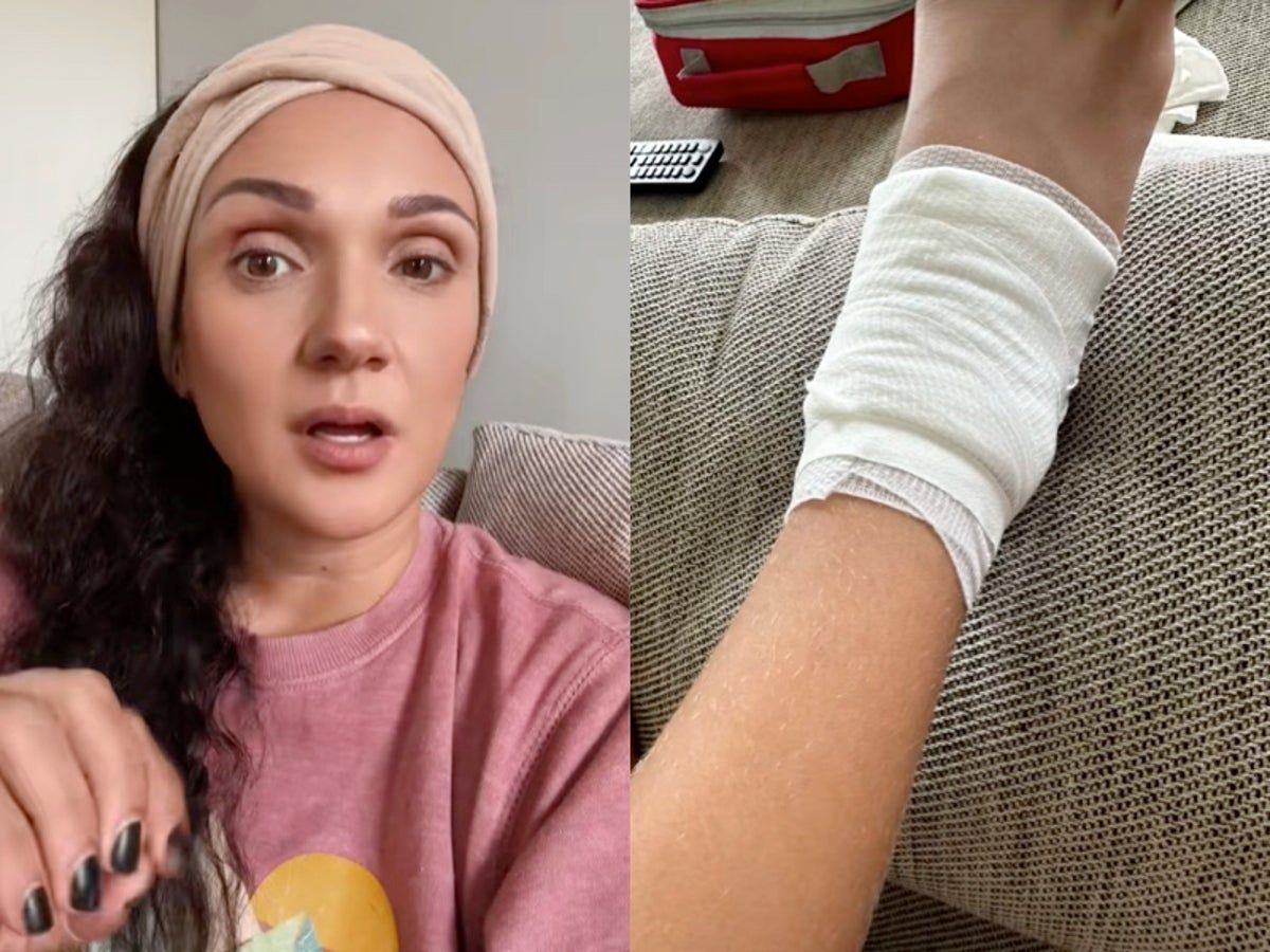 Mother issues warning after daughter suffers…