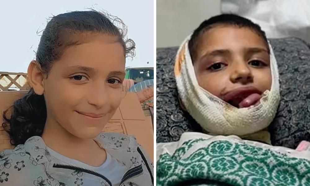 Mazyouna’s face was ‘ripped off’ when a rocket hit her…