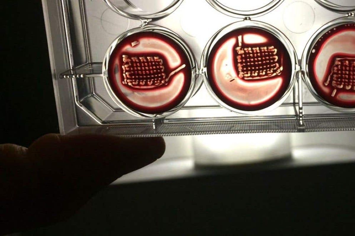 Patients’ own blood could be used to help repair…