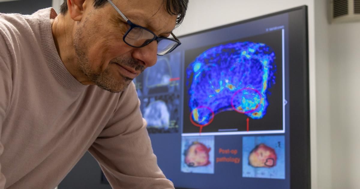 Scottish university's prostate cancer imaging shows…