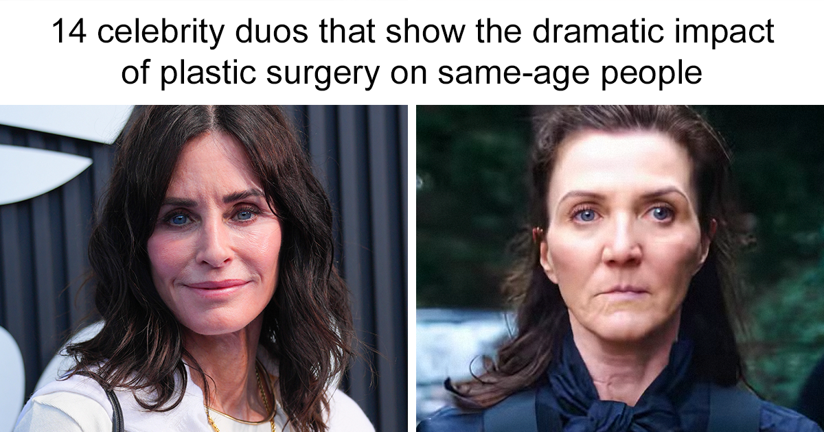 The Striking Impact Of Plastic Surgery On Same-Age…