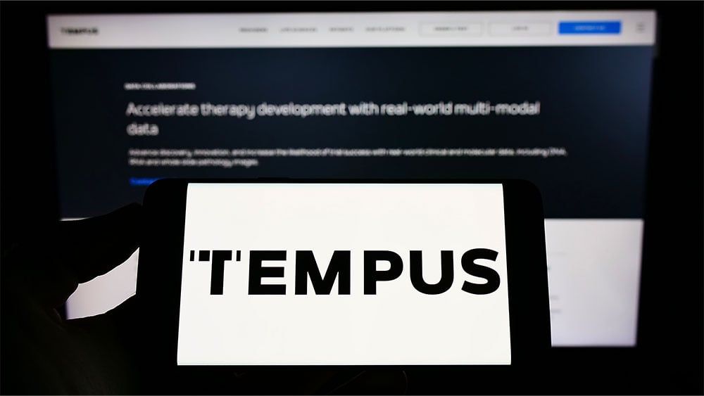 Tempus AI Reverses 192% Run. Why At Least One Analyst… Tempus AI Reverses 192% Run. Why At Least One Analyst…