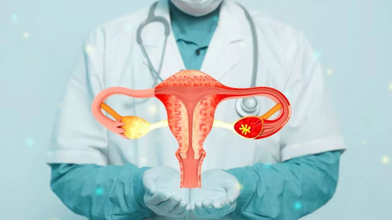Doctor reveals 4 hidden signs of ovarian cancer