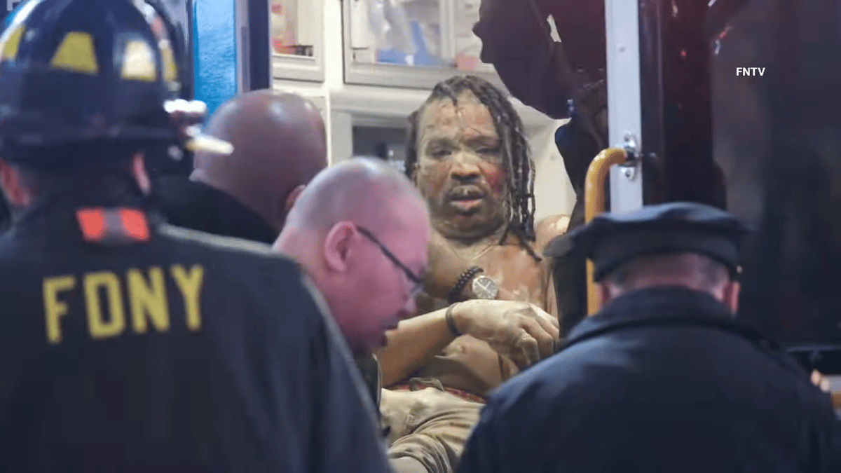 Arsonist on the loose after setting man ablaze in New…