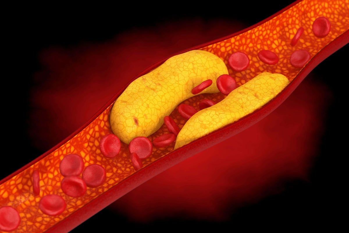 Experts reveal the truth about cholesterol – and how…