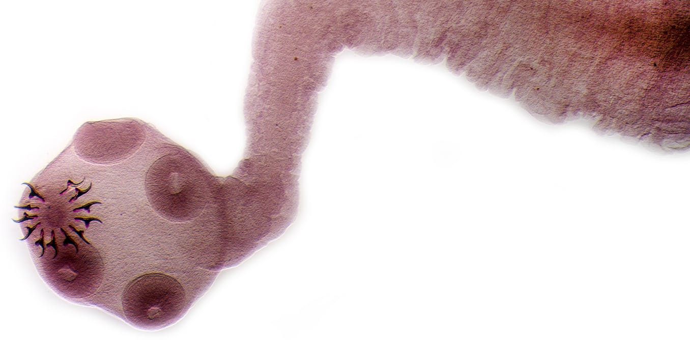 How eating undercooked pork could leave your body and…