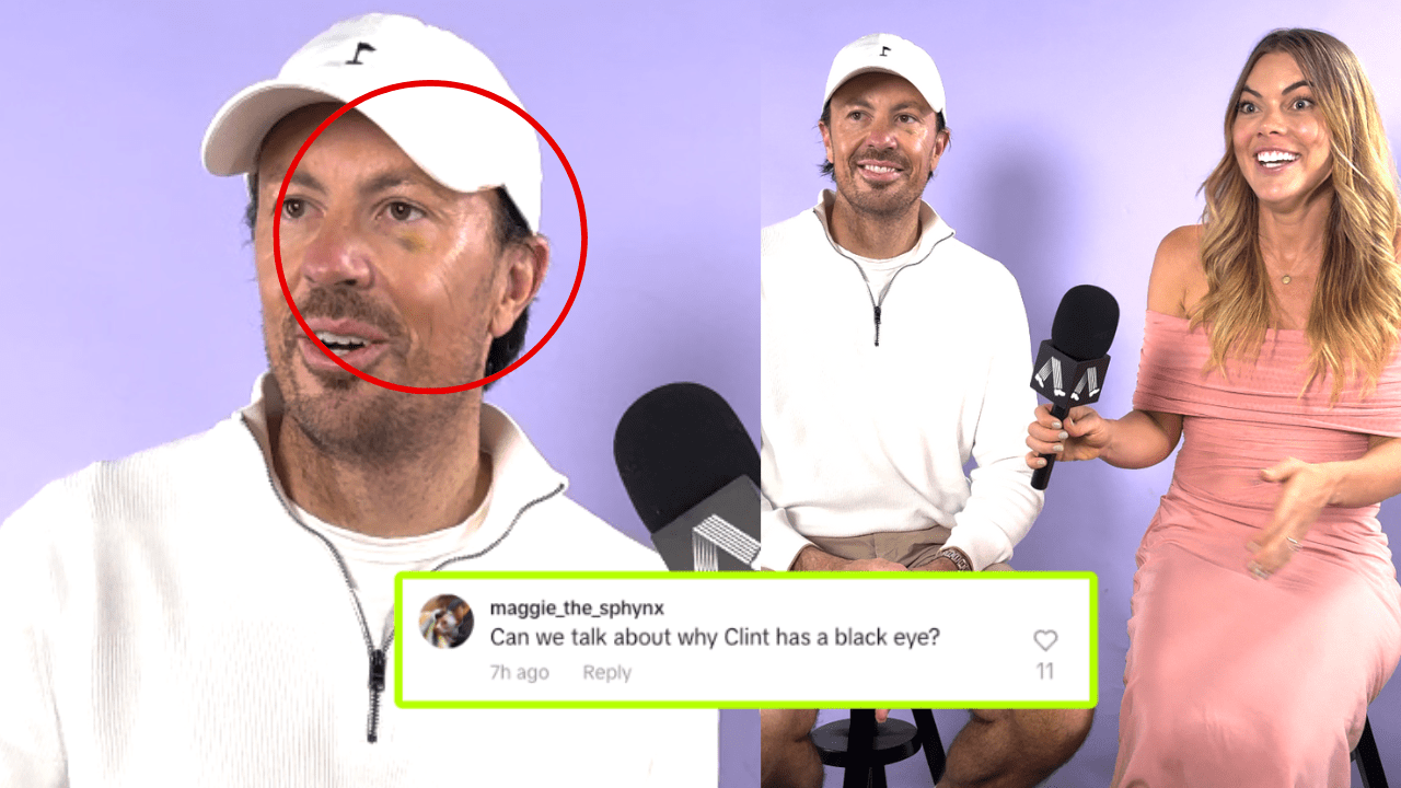 MAFS Groom Clint Rice Reveals Why He Had A Black Eye…