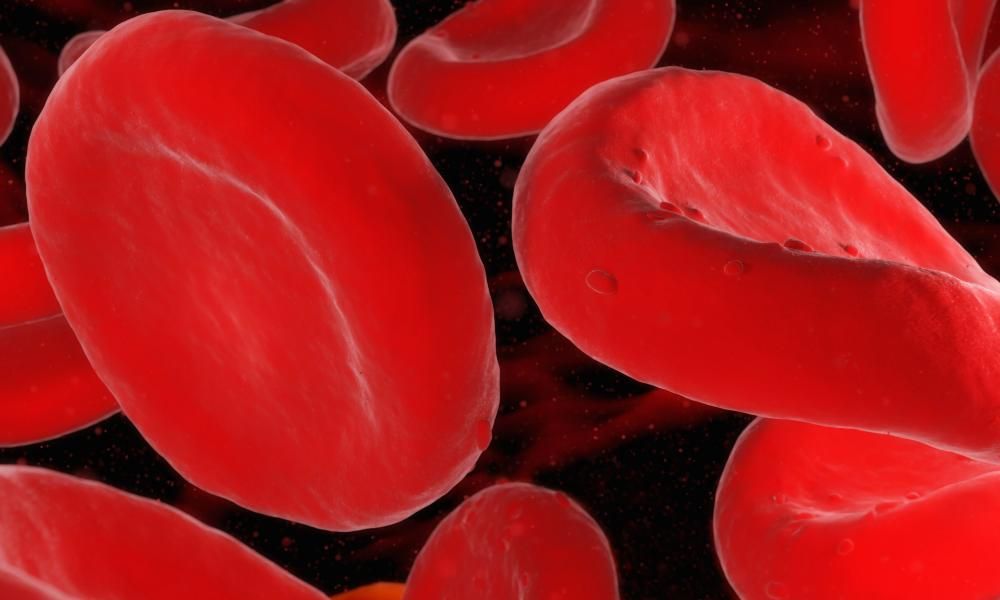 Hemosep: the machine set to revolutionise blood…