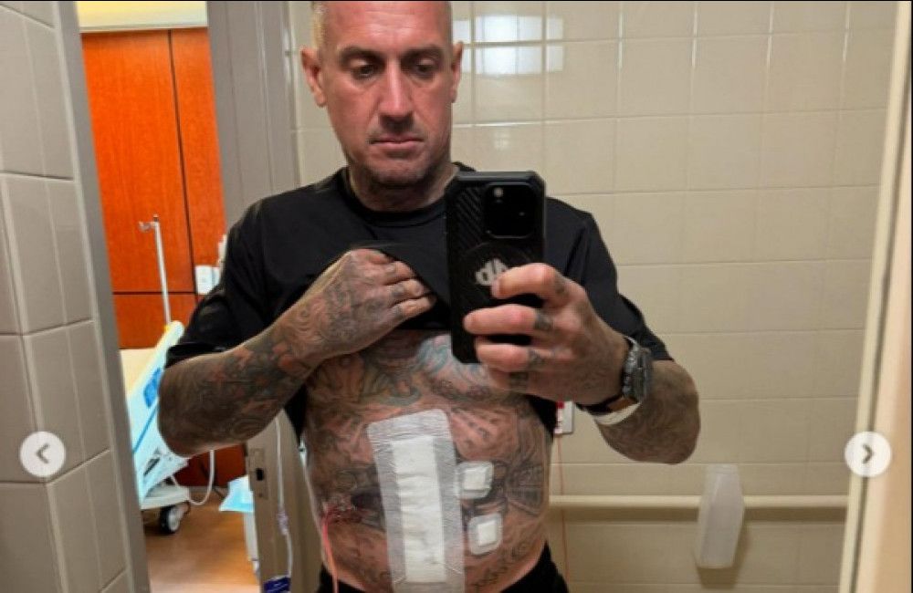 Carey Hart injured in motocross training accident
