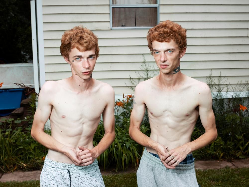 Derek and Quentin, twins from Indiana who live in the…
