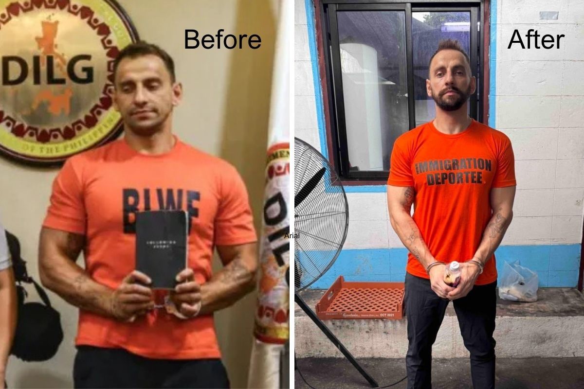 Vitaly Zdorovetskiy 'Before and After' Photos Amid…