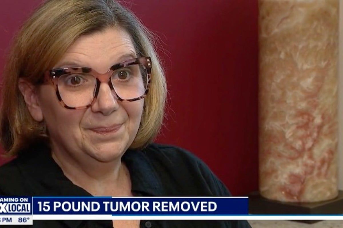 Cancer patient travels 300 miles to have 15 pound…