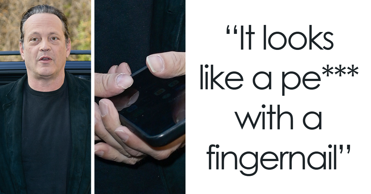 20 Bizarre Celebrity Body Anomalies That Left Fans…