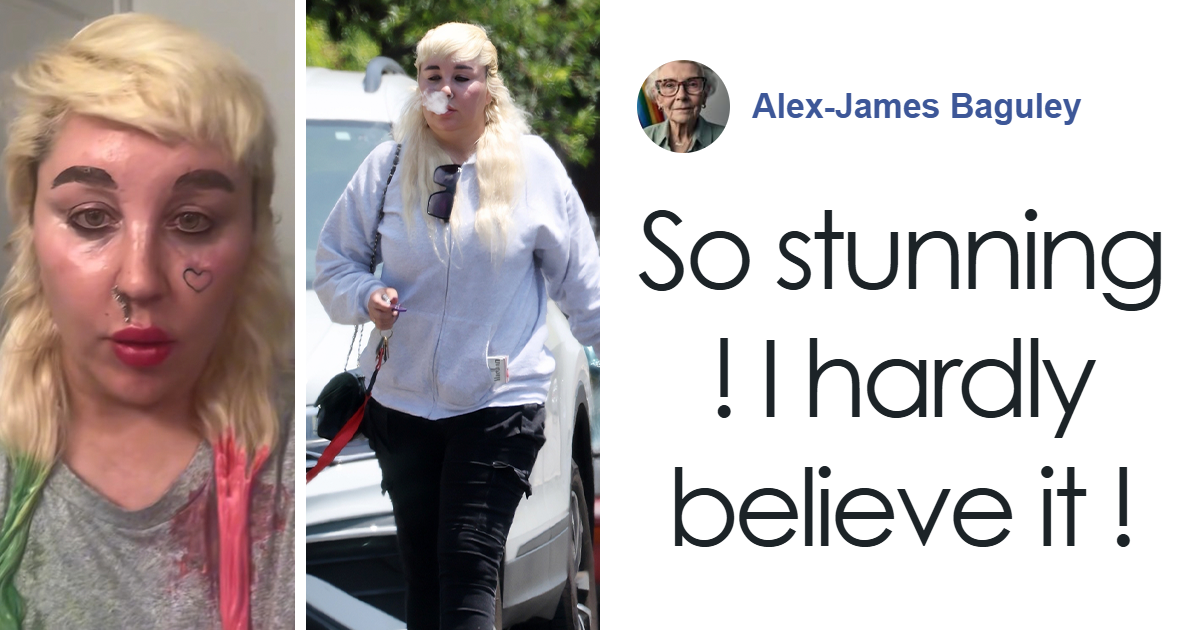 Amanda Bynes Steps Out After Revealing She’s Using…