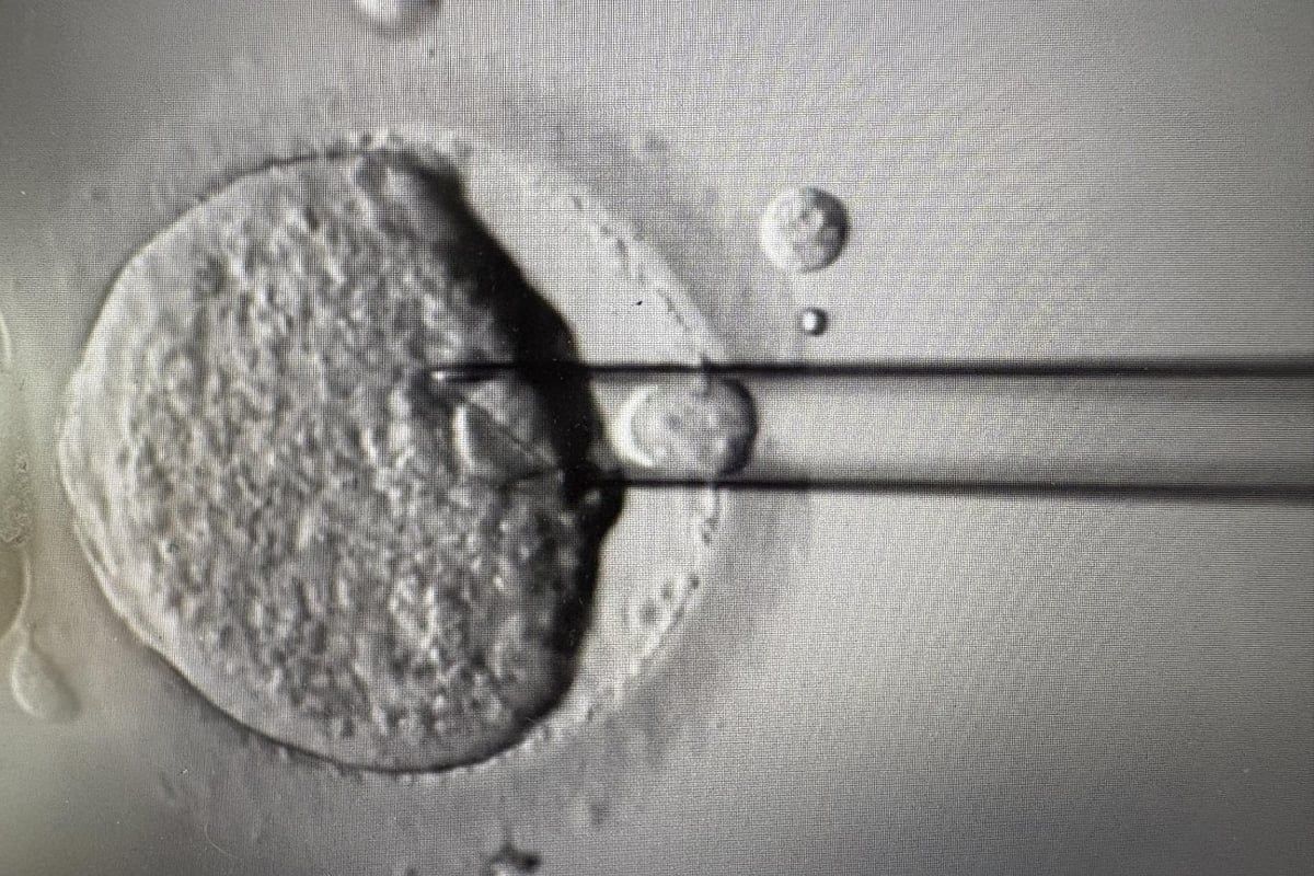 Eight babies born from pioneering IVF technique to…