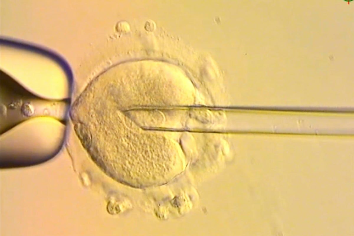 IVF technique using DNA from three people sees eight…