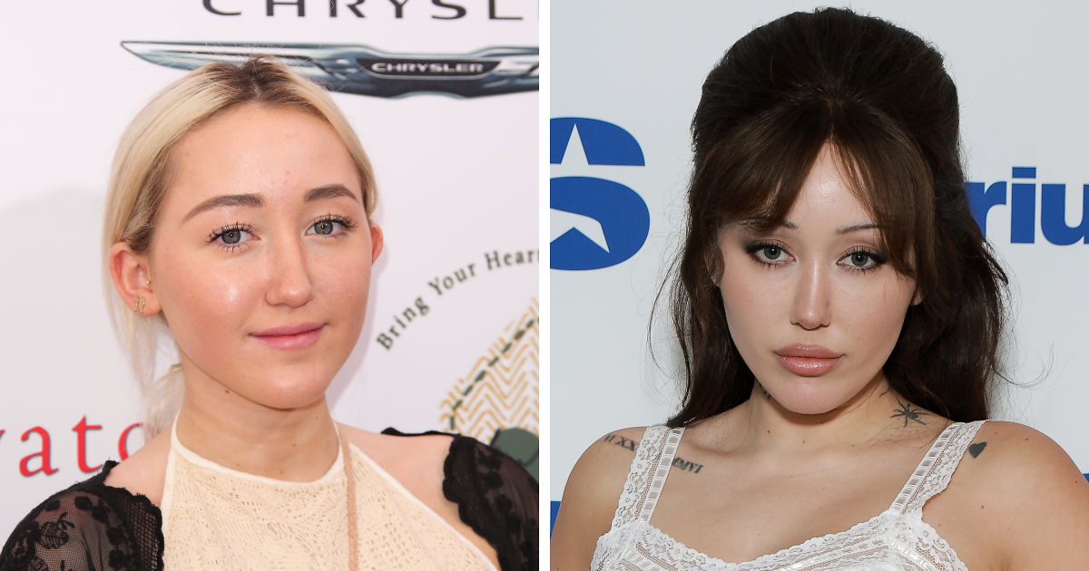 Miley Cyrus’ Sister Noah, 25, Sparks Plastic Surgery…