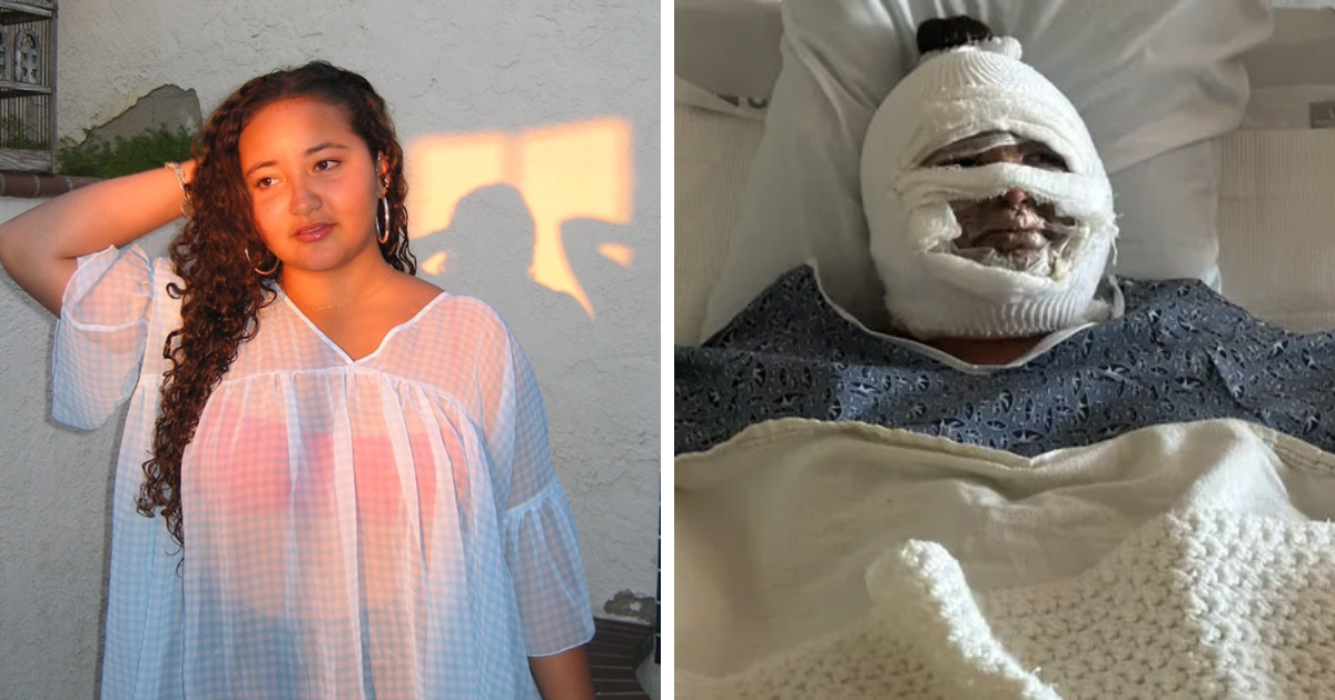 “Hope She Gets A Good Product Attorney”: Teen Suffers…