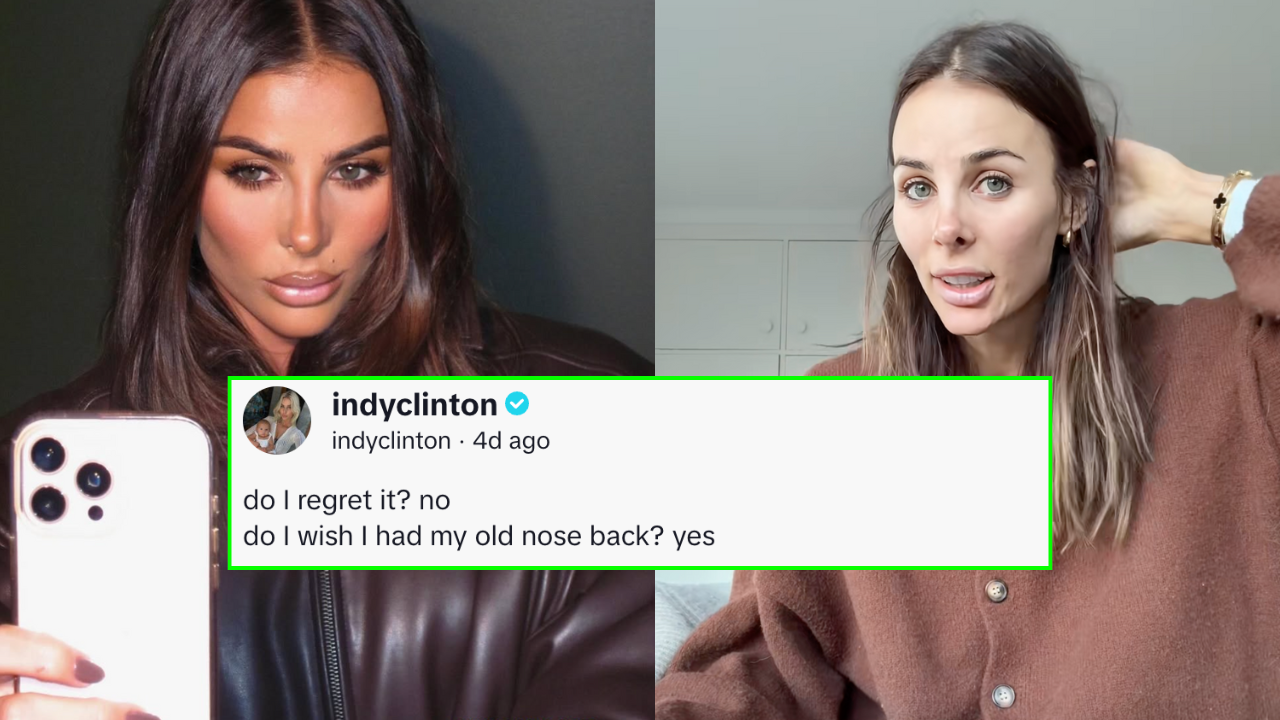 Indy Clinton Opens Up About Her Nose Job: ‘Do You Guys…