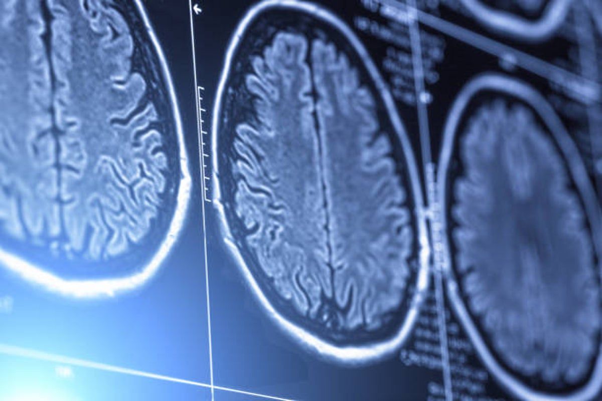 Your brain could get bigger – not smaller – as you…