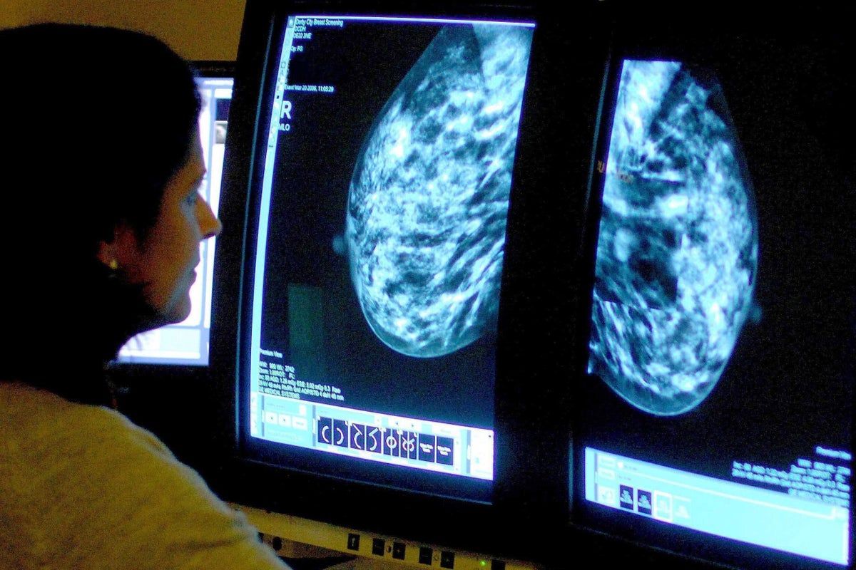 How routine breast screenings could help predict heart…