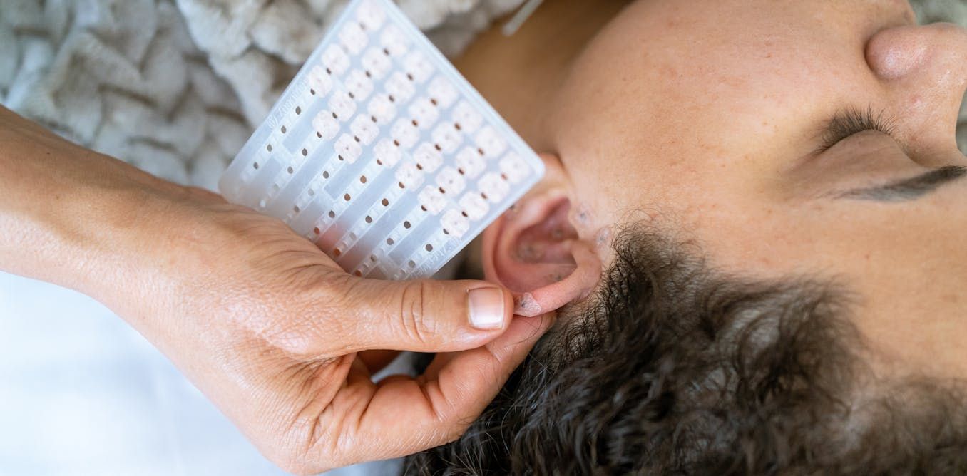 What is ‘ear seeding’, the TikTok trend said to treat…