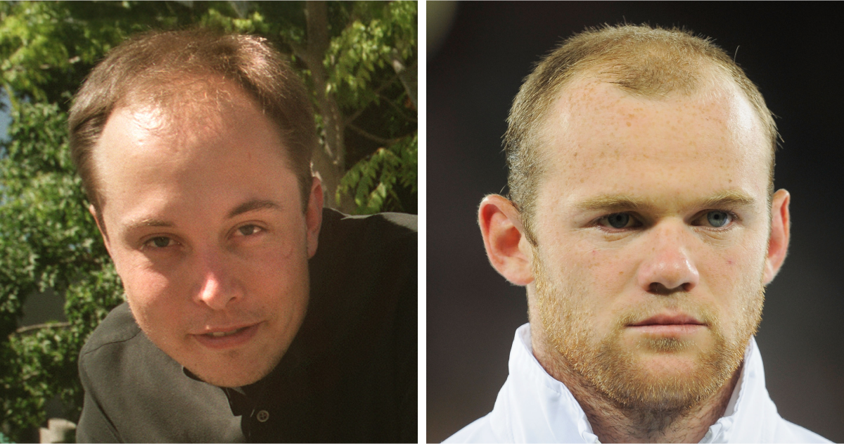 19 Celebrities Who Look Noticeably Better After Hair…