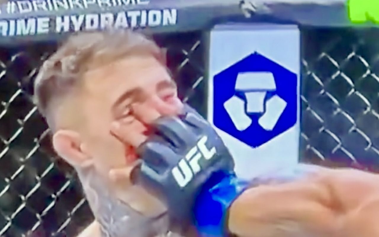 Tom Aspinall Left Half-Blind, Furious at UFC 321…