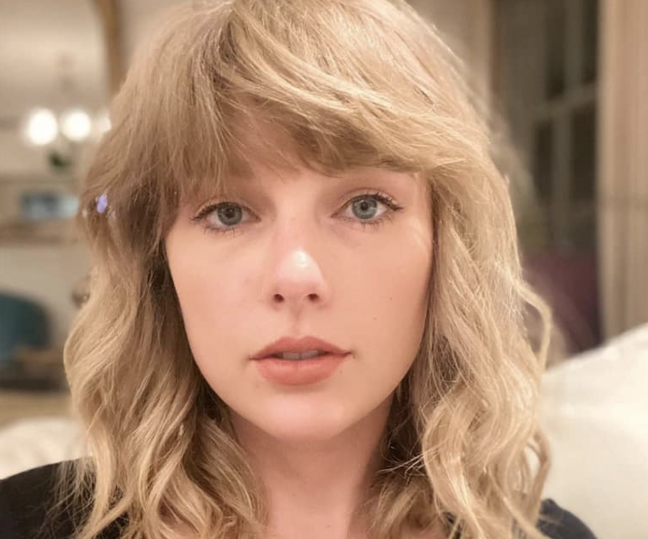Taylor Swift Botched Botox: Why Pop Star's Filler…