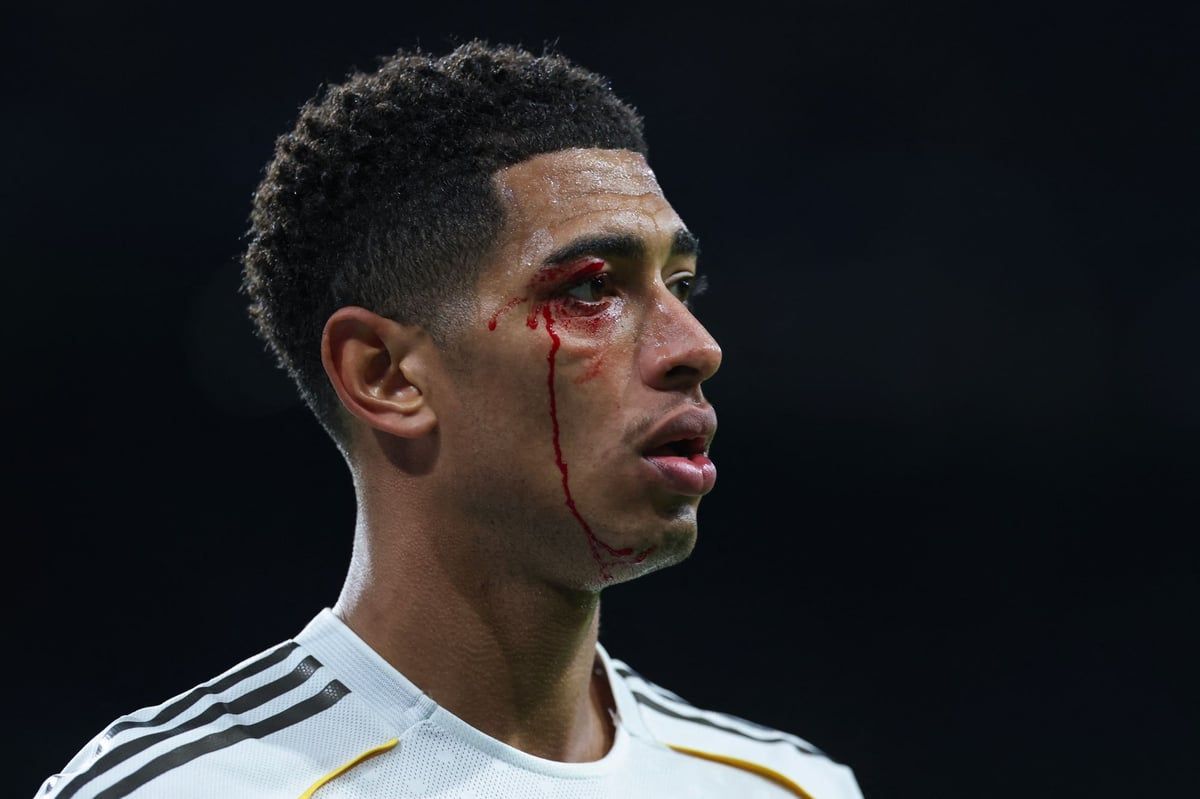 Jude Bellingham suffers horror cut as nine-man Real…