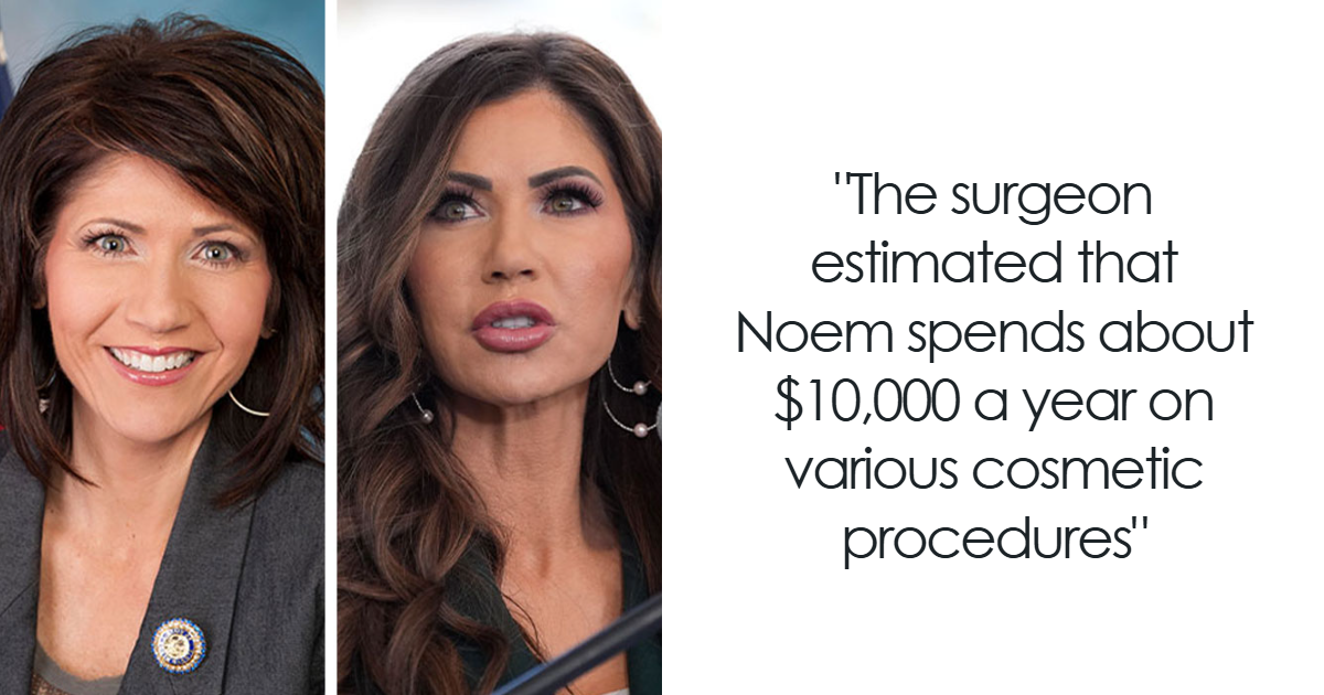 10 “Mar-a-Lago” Face Transformations That Left People…