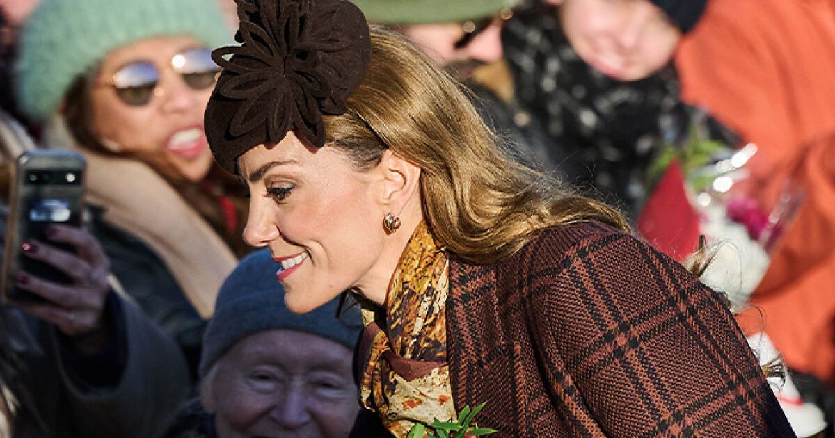 Kate Middleton’s Facial Scar Fuels Rumors Her 2024…