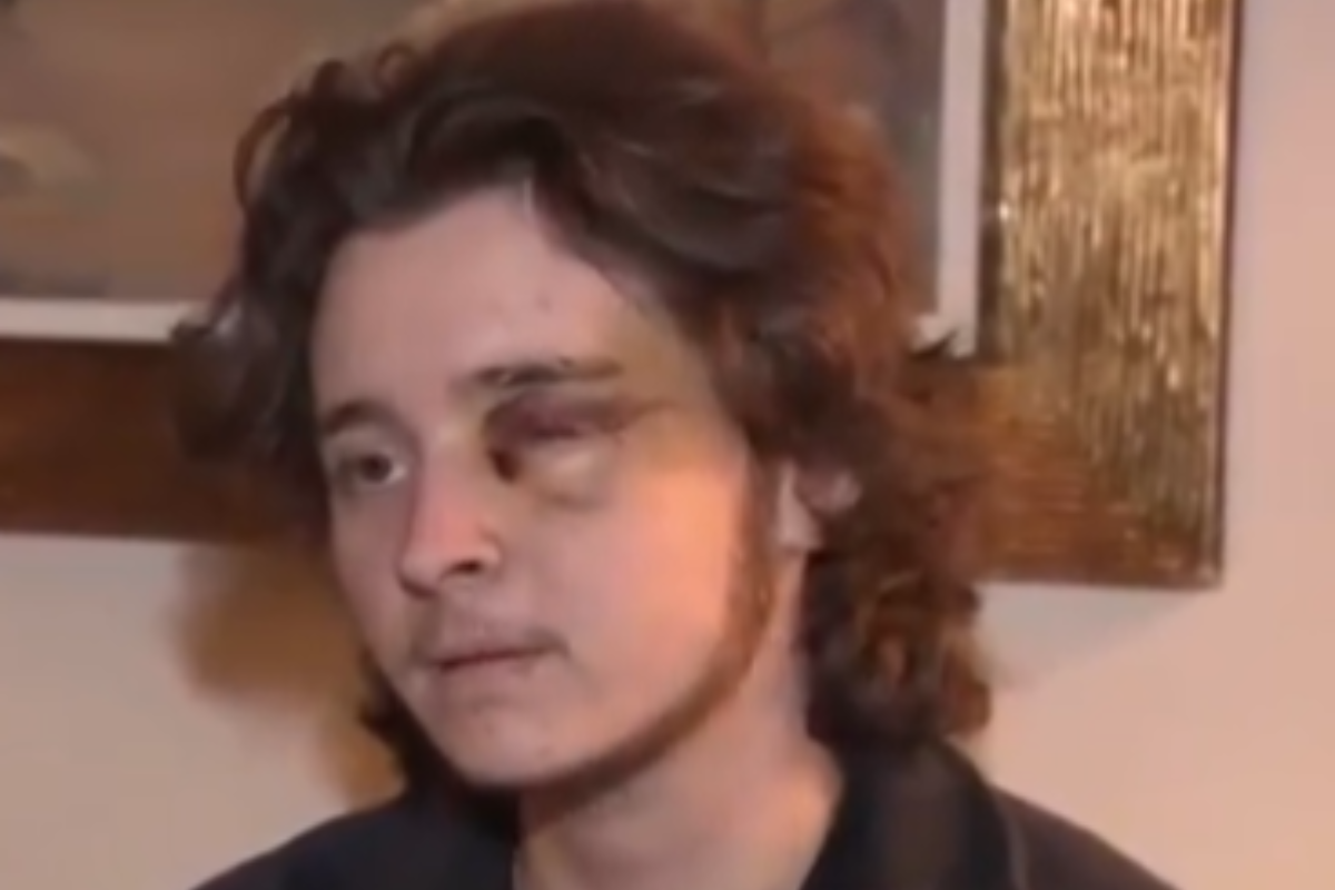 ICE Agent Shoots Protester in Face at Point-Blank…