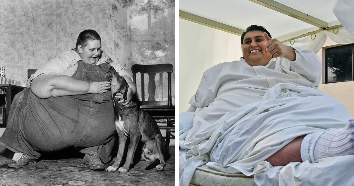 Remarkable Stories Of The Heaviest Recorded People In…