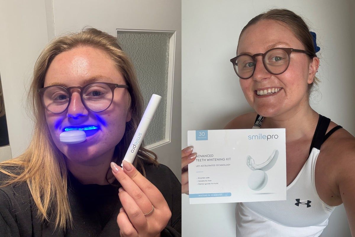 This whitening kit brightened my teeth in just 30…