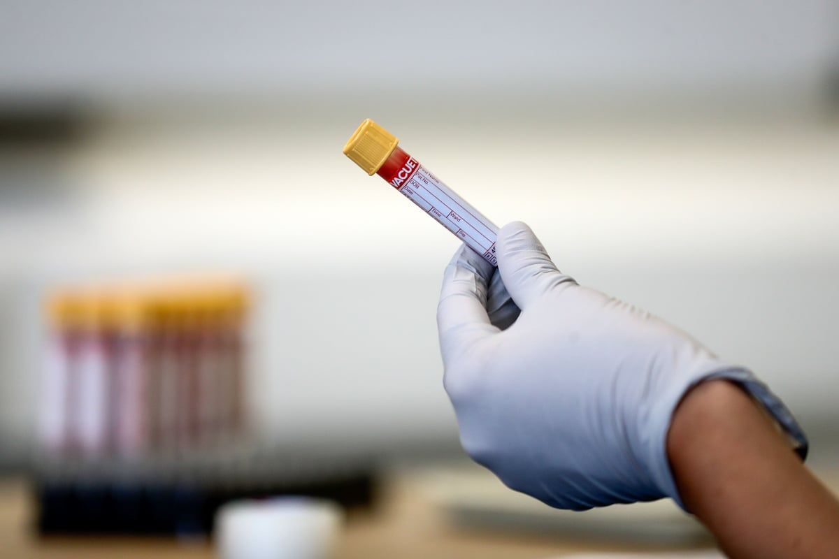 Early detection cancer tests ‘could be part of NHS…