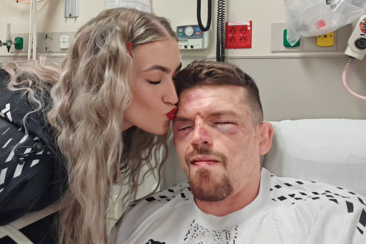British UFC star Harry Hardwick shares grisly video…
