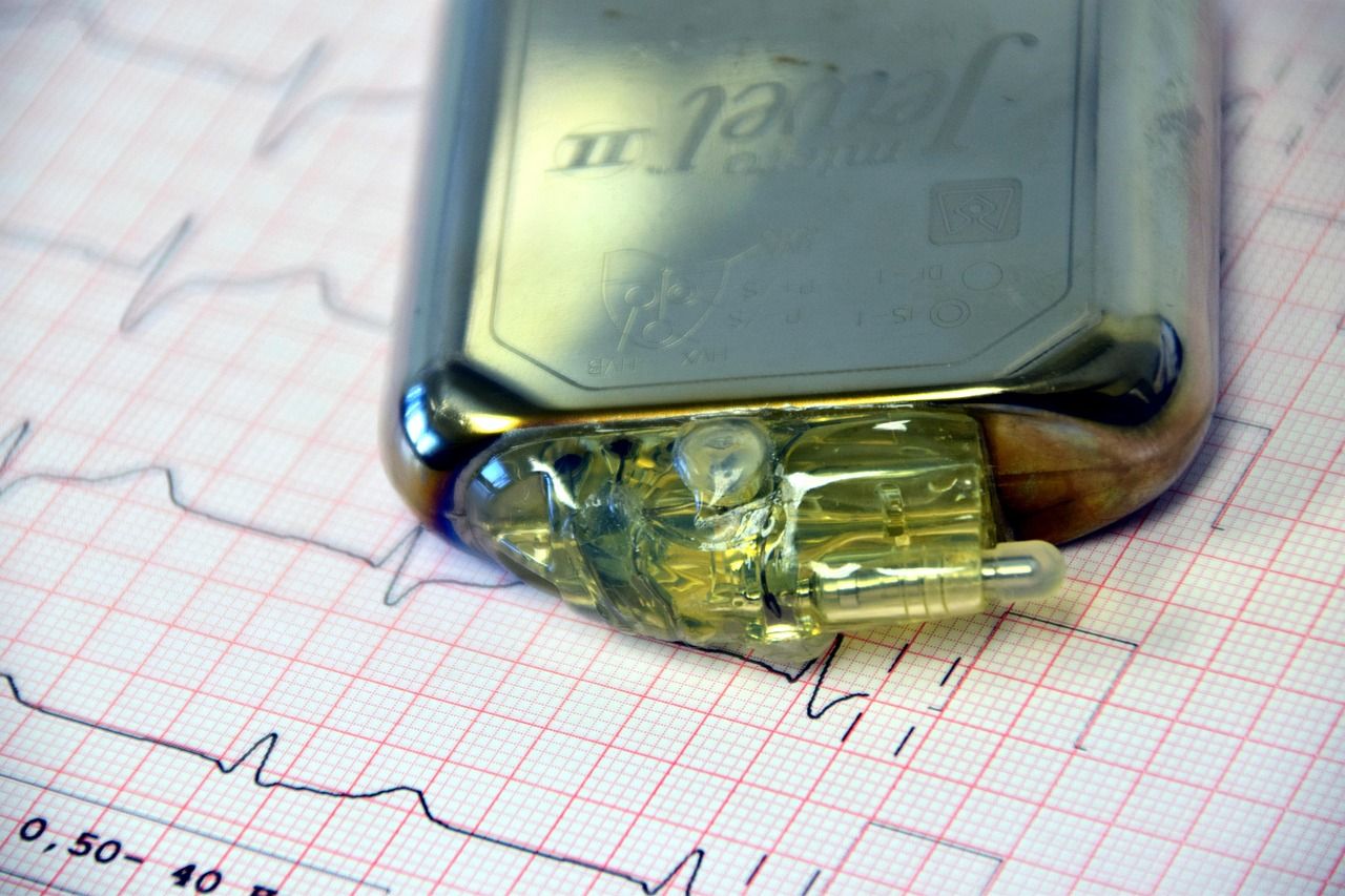 Pacemaker vs ICD: How Pacing, Leads and Shocks Help…