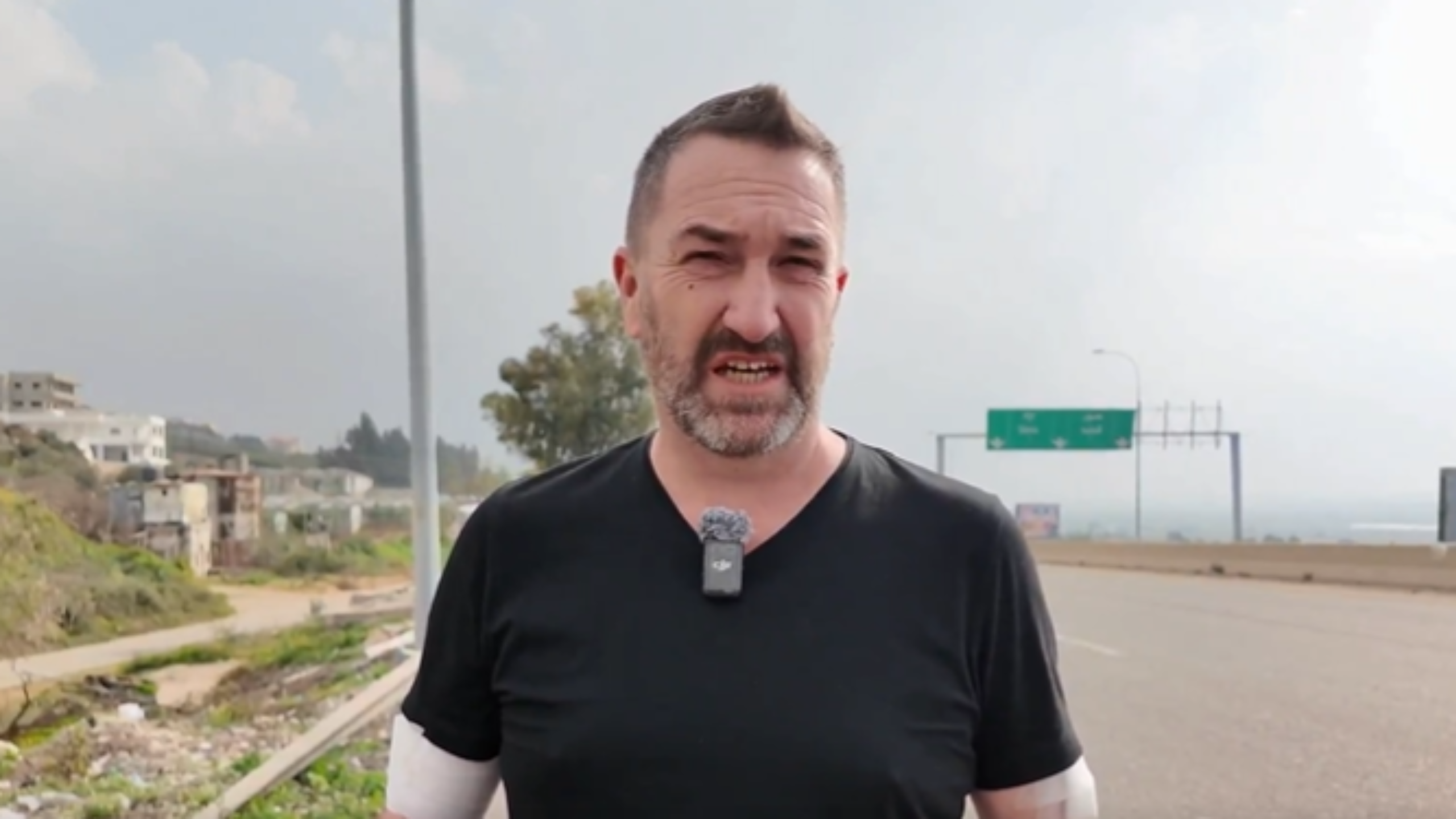 10 Photos of British Journalist Steve Sweeney Injured…