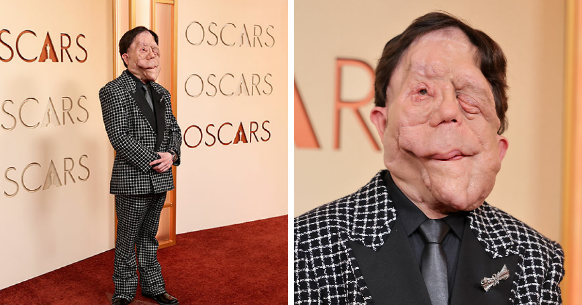 Adam Pearson Joins Fans In Calling Out Comedian’s…