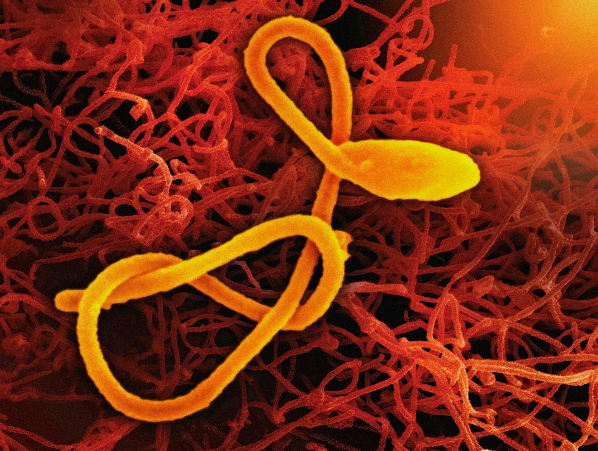 Ebola Response Efforts in Africa Threatened by US Aid…
