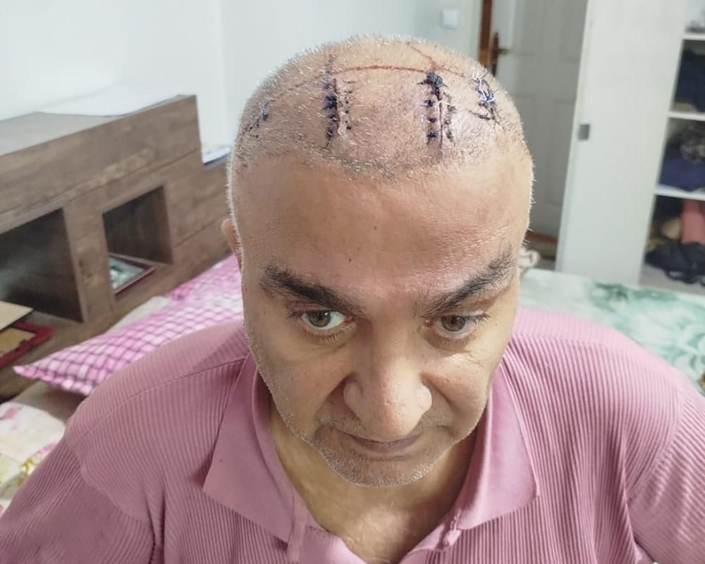 ‘They beat me until I lost consciousness’: growing…