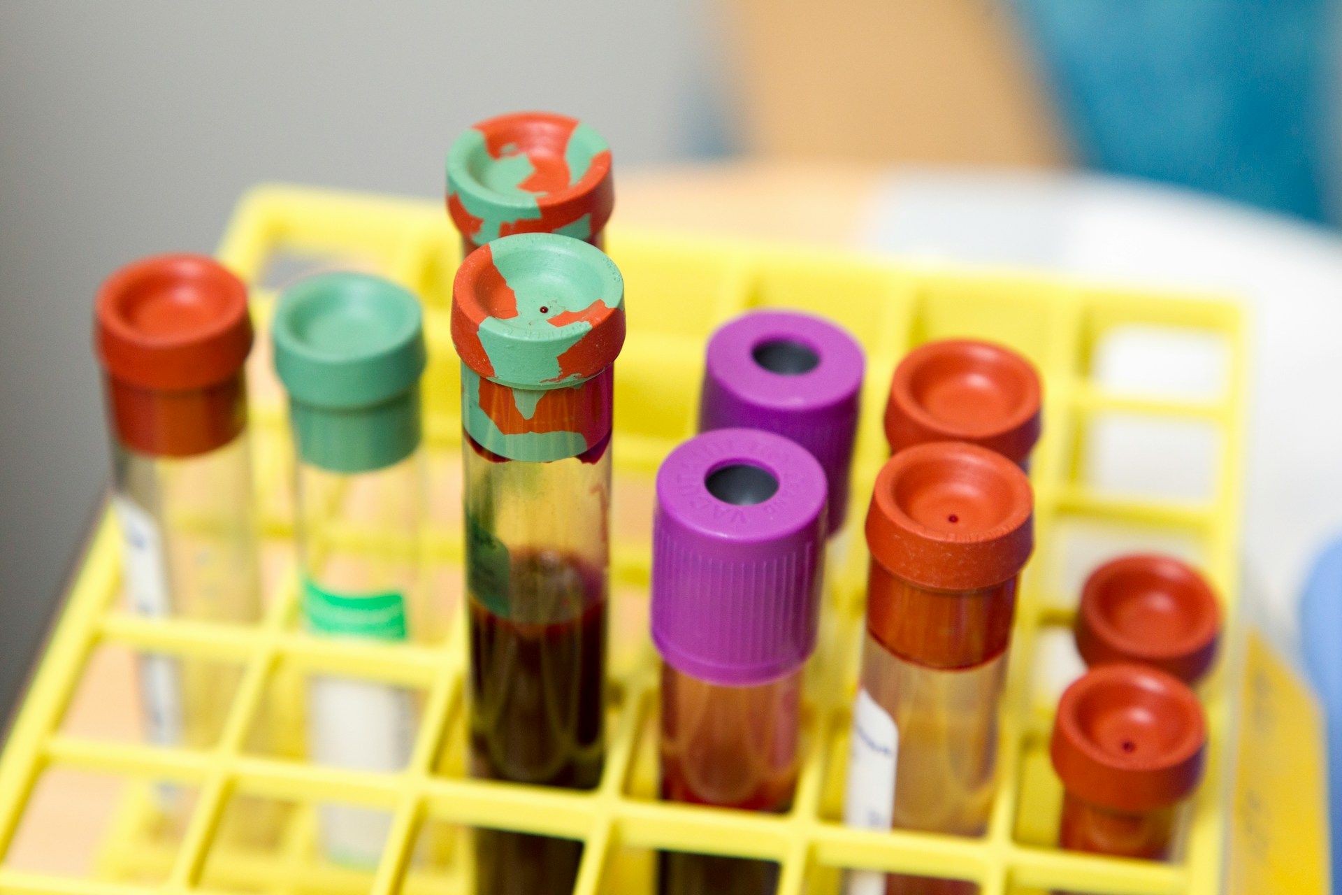 Vials Found in Large Case at Detroit Airport: 2…