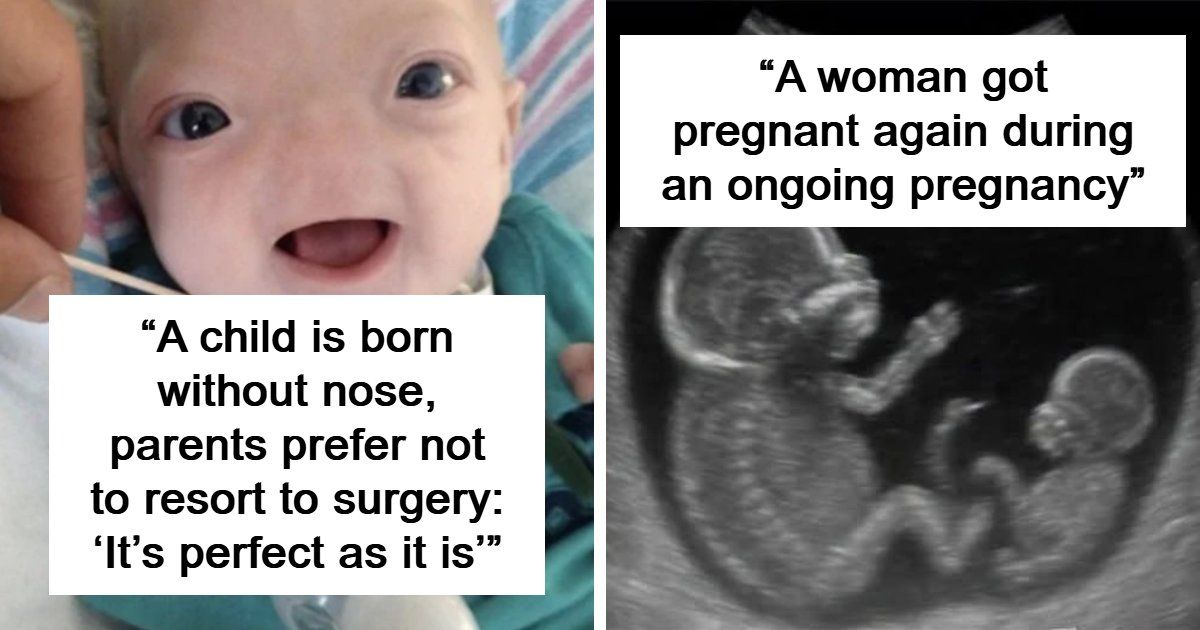 “The Patient Has 81 Teeth”: 61 Facts About Health And…