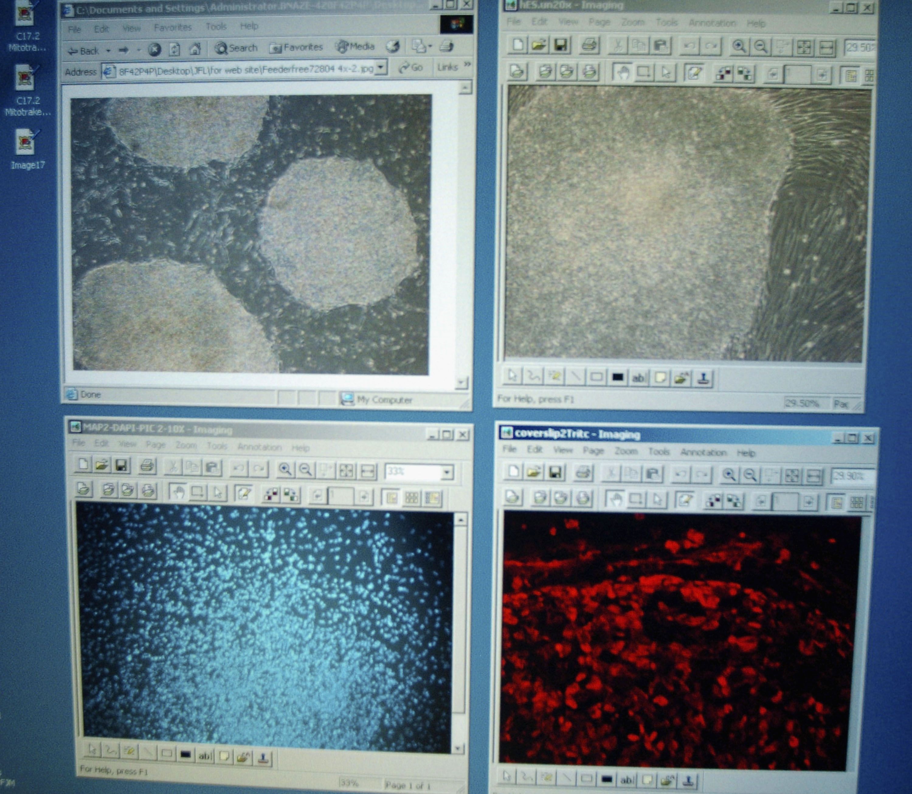 Mount Sinai Scientists Reverse Aging in Blood Stem…