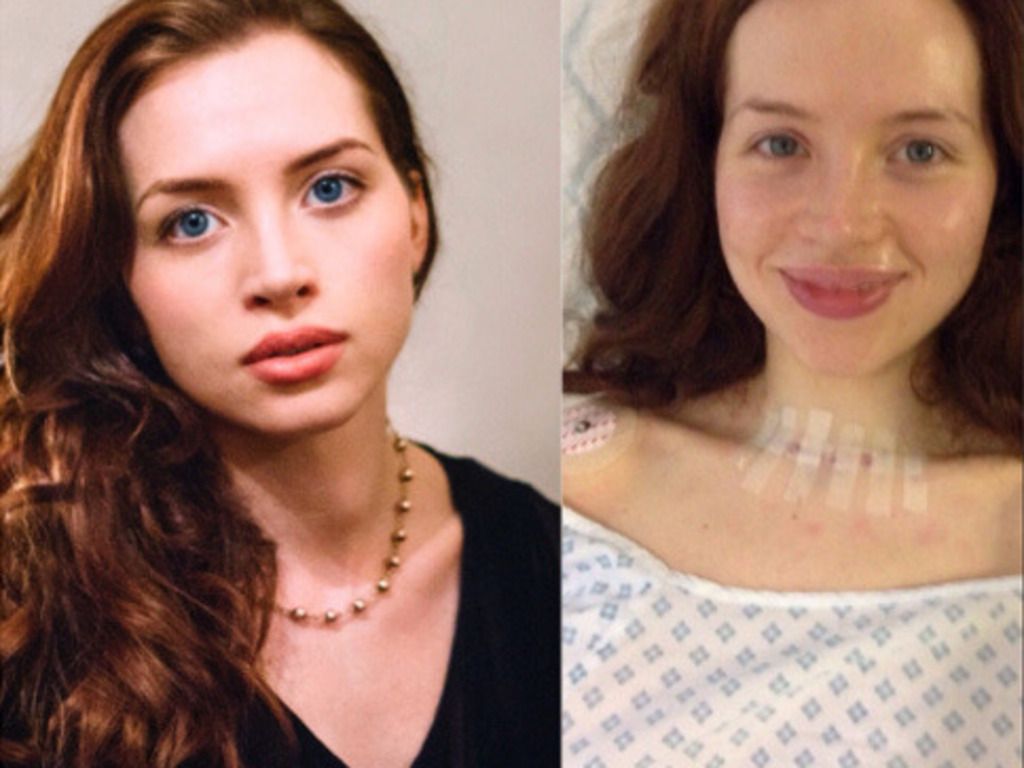 Actress speaks out about the subtle cancer symptoms…