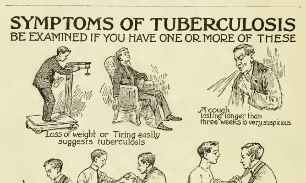 The Fall and Rise of Tuberculosis: A First World…