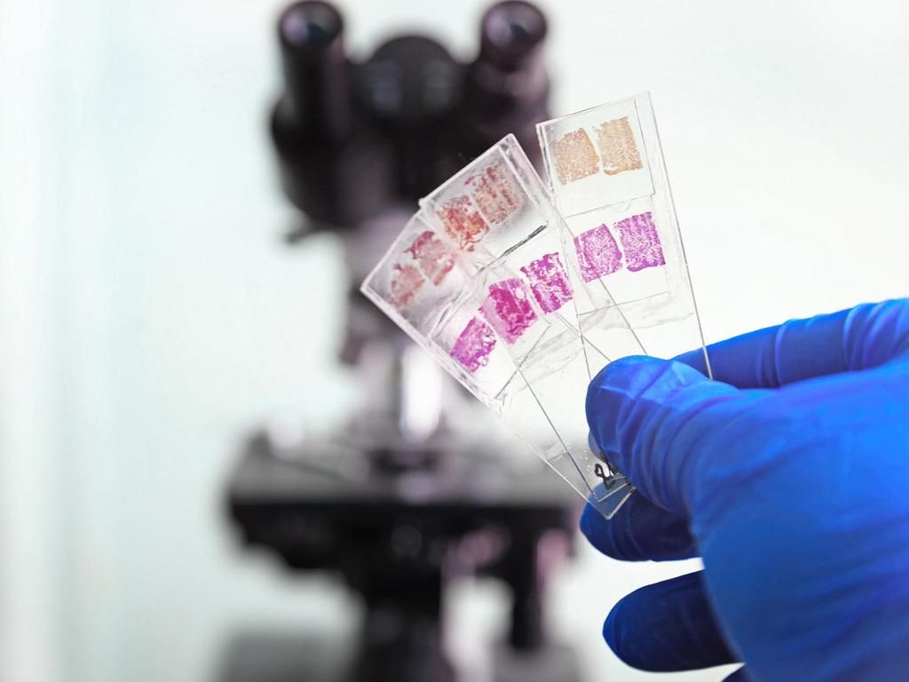 Interstitium: New organ discovered in human body after…