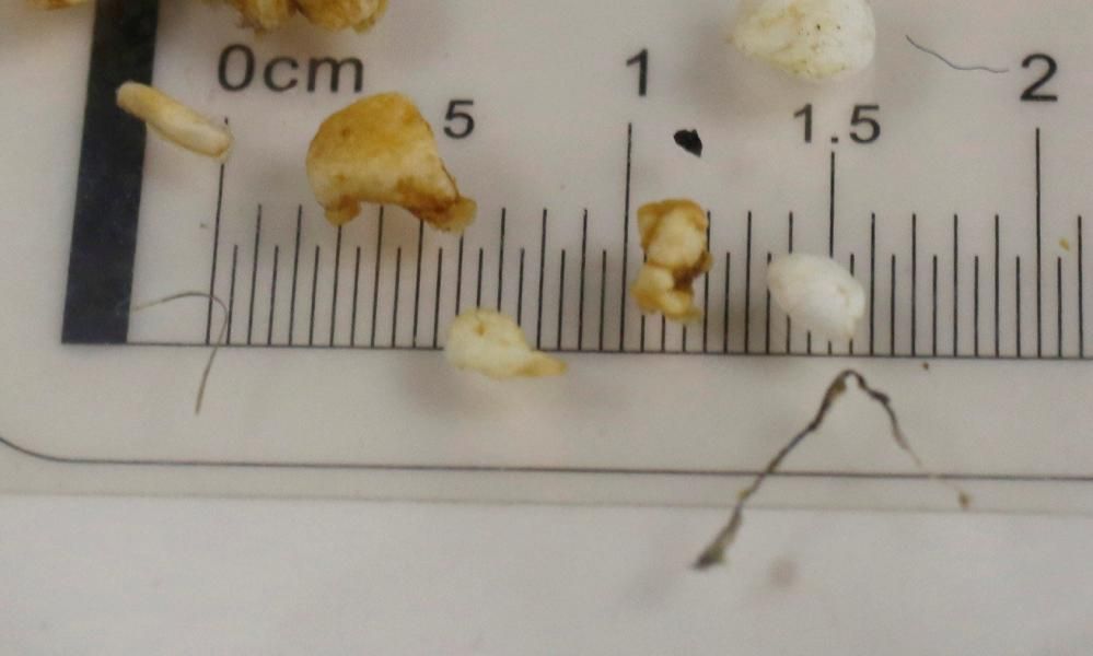 Microplastics found in every marine mammal surveyed in…